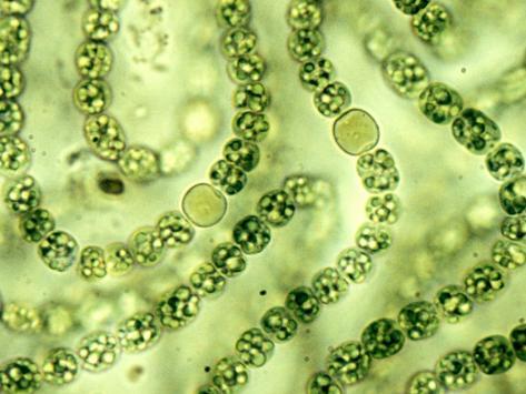 Nostoc Cyanobacteria, with Heterocysts Important in Nitrogen Fixation ...
