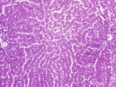 Cross Section of the Human Liver, LM X100 Photographic Print by Ralph ...