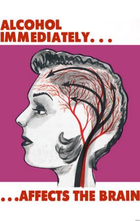 Brain On Alcohol Poster
