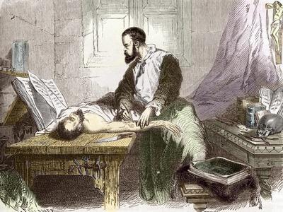 'Andreas Vesalius during Dissection of a Human Body' Giclee Print ...