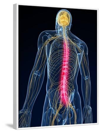 'Back Pain, Conceptual Artwork' Photographic Print - SCIEPRO ...