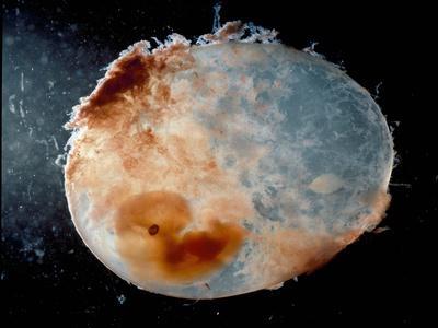 'Biology and Pregnancy: Amniotic Pocket Containing the Human Embryo ...