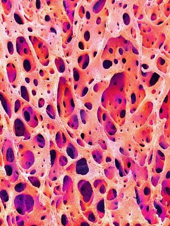'Bone Tissue of Chicken' Photographic Print - Micro Discovery ...