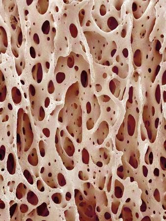 'Bone Tissue' Photographic Print - Micro Discovery | AllPosters.com