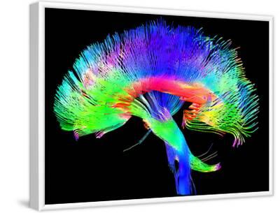 'Brain Pathways' Photographic Print - Tom | AllPosters.com