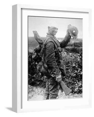 'British Soldier with Bandaged Head Shows the Steel Helmet That Saved ...