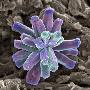 'Calcium Phosphate Crystal, SEM' Photographic Print - Steve ...