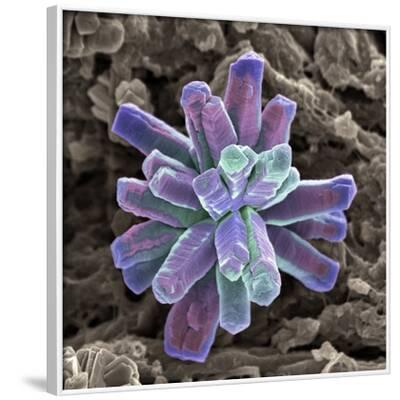 'Calcium Phosphate Crystal, SEM' Photographic Print - Steve ...