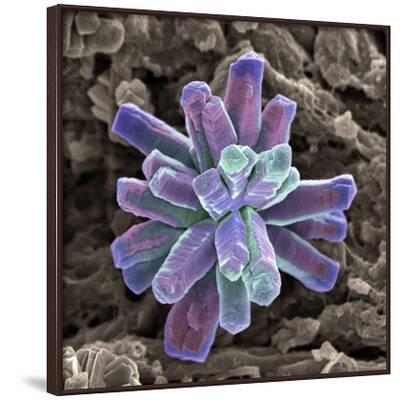 'Calcium Phosphate Crystal, SEM' Photographic Print - Steve ...