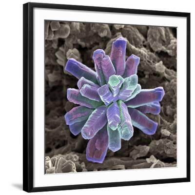 'Calcium Phosphate Crystal, SEM' Photographic Print - Steve ...