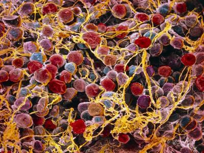 'Coloured SEM of Adipose Tissue Showing Fat Cells' Photographic Print ...