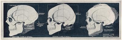 'Comparison of British and German Skull Shapes, WW1' Posters ...
