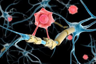 'Conceptual image of a multiple sclerosis neuron healed by a T-cell ...