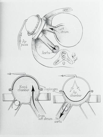 'Diagram of Artificial Heart Compression' Giclee Print | AllPosters.com