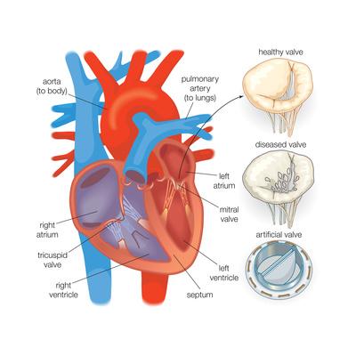'Diagram of the Human Heart - Valve Examples' Poster - Encyclopaedia ...