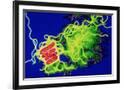 'Legionella Bacteria' Photographic Print - Dr. Linda Stannard ...