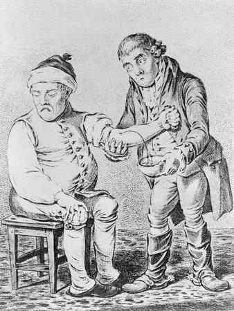 'Early Physician Bloodletting a Patient' Giclee Print | AllPosters.com