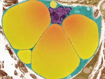 'Fat Cell, TEM' Photographic Print - Steve Gschmeissner | AllPosters.com