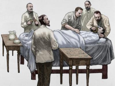 'History of Medicine. Chloroform Anesthesia. Engraving, 19Th Century ...