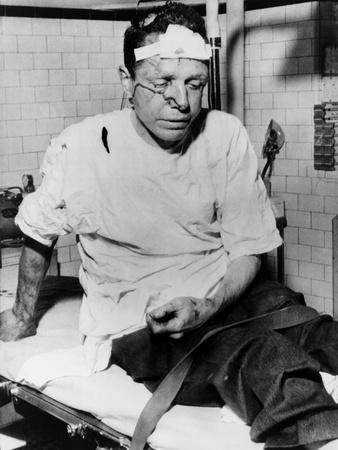 'James Peck, Bleeding after an Attack on a 'Freedom Riders' Bus ...