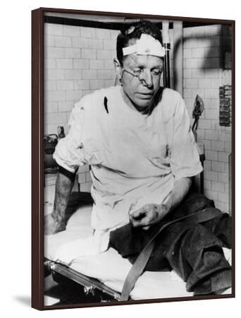 'James Peck, Bleeding after an Attack on a 'Freedom Riders' Bus ...