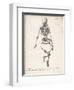 'Skeleton of an Adult Patient Afflicted with Rickets' Giclee Print ...