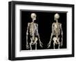 Front and back perspective views of upper body human skeleton, black ...