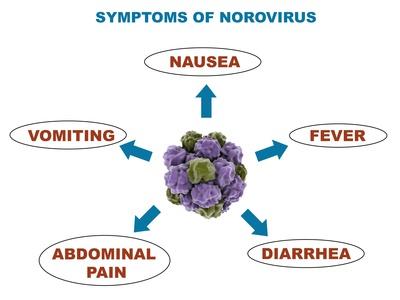 'Medical diagram showing symptoms of the norovirus.' Prints - Stocktrek ...