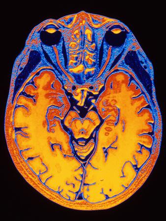 'MRI Brain Scan' Photographic Print - PASIEKA | AllPosters.com