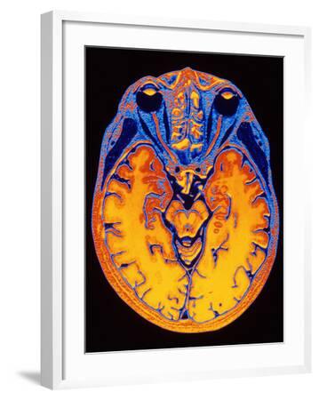 'MRI Brain Scan' Photographic Print - PASIEKA | AllPosters.com