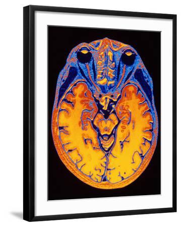 'MRI Brain Scan' Photographic Print - PASIEKA | AllPosters.com