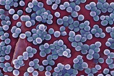 'MRSA Bacteria, SEM' Photographic Print - CDC | AllPosters.com