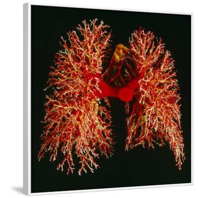 'Resin Cast of Pulmonary Arteries And Bronchi' Photographic Print ...