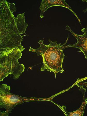 'Neural Stem Cell Culture' Photographic Print - Riccardo Cassiani ...