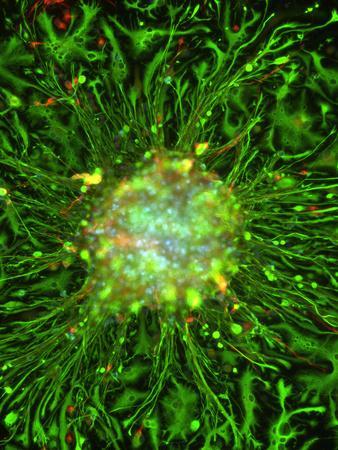 'Neural Stem Cell Culture' Photographic Print - Riccardo Cassiani ...