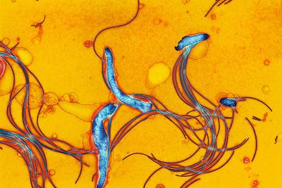 'Spirochete Bacteria, TEM' Photographic Print - Hazel Appleton ...