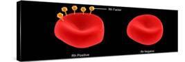 Conceptual illustration of Rh factor on a red blood cell. Prints ...