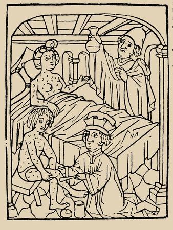 'Syphilis treatment: Treatment with ointments (mercury)' Giclee Print ...