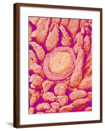 'Taste bud cell and tongue filiform papillae of a rabbit magnified x300 ...