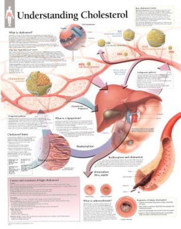 'Understanding Cholesterol Educational Chart Poster' Posters ...