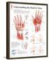 'Understanding the Hand and Wrist Educational Chart Poster' Poster ...