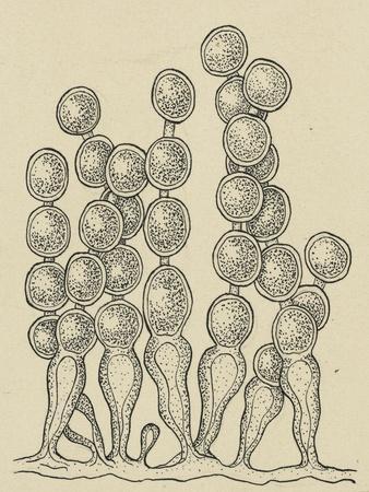 'White Rust Sporangia (Albugo Candida Fungus), Ficomiceti' Giclee Print ...