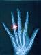 'X-ray of hand with diamond ring' Photographic Print - Thom Lang ...