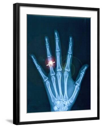 'X-ray of hand with diamond ring' Photographic Print - Thom Lang ...