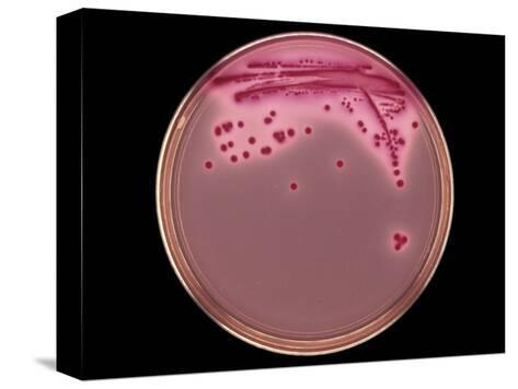 E Coli Colony Morphology On Macconkey Agar Plate E.Coli Bacterial