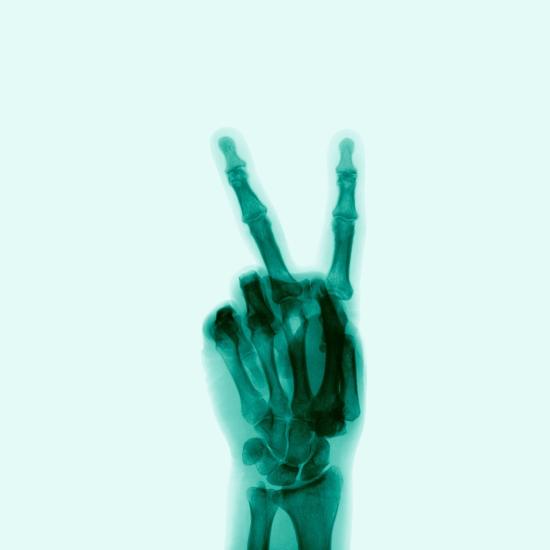 'X-Ray of Hand Doing Peace Sign' Photographic Print | AllPosters.com