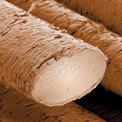 'Human Hair Magnified 1250x' Photographic Print | AllPosters.com