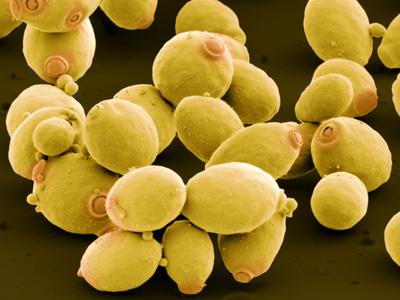 Yeast (Saccharomyces Cerevisiae) Budding and with Bud Scars, SEM X6000 ...