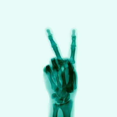 'X-Ray of Hand Doing Peace Sign' Photographic Print | AllPosters.com